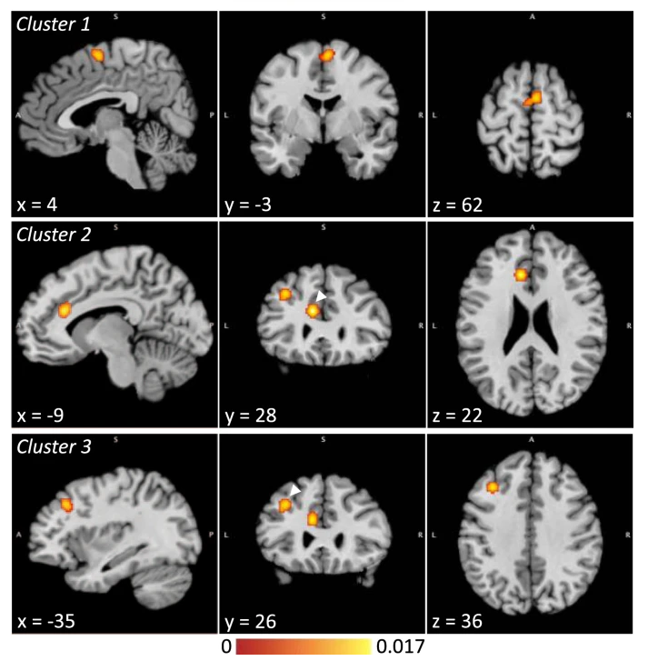 VOCÊ ESTÁ SOFRENDO de “BRAIN ROT” - PODRIDÃO DO CÉREBRO? - Instituto ...